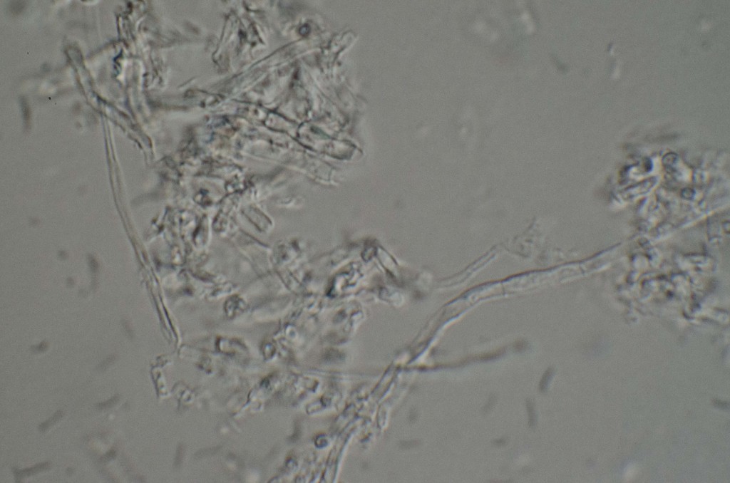 Curing Snake Fungal Disease - Bioinnovation Laboratory
